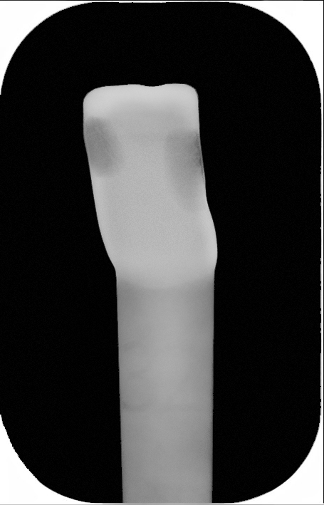 Leeds 3D Printed Model | Leeds Digital Dentistry