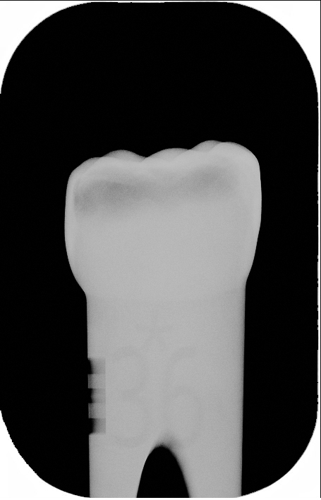 Leeds 3D Printed Model | Leeds Digital Dentistry