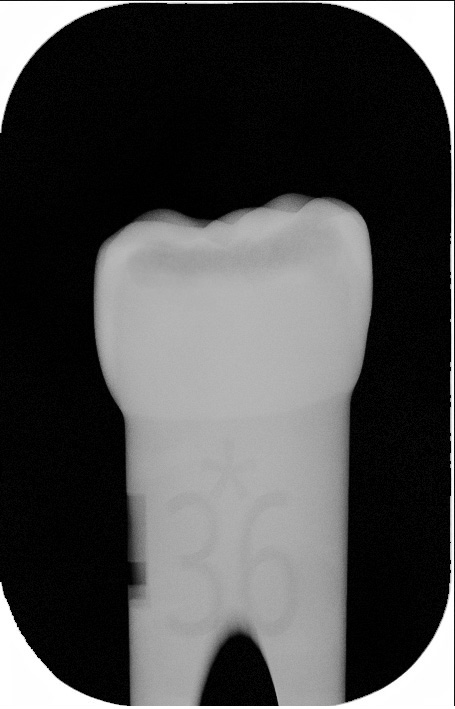 Leeds 3D Printed Model | Leeds Digital Dentistry