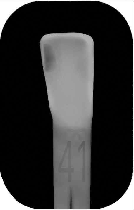 Leeds 3D Printed Model | Leeds Digital Dentistry