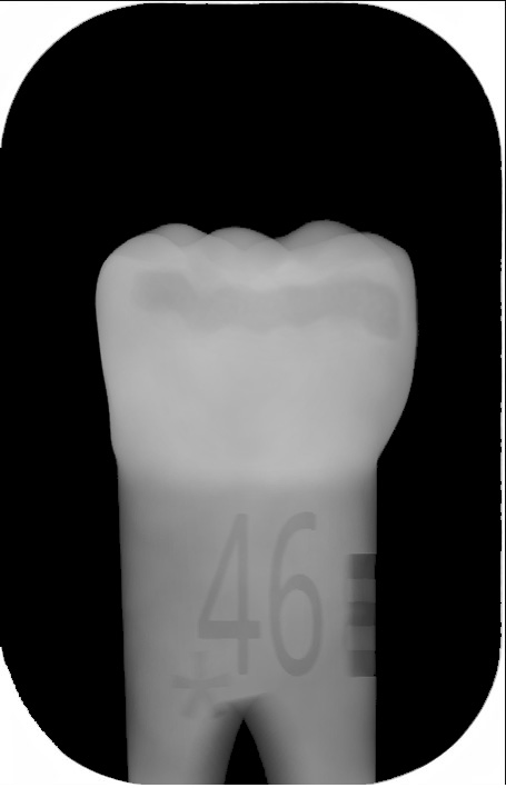 Leeds 3D Printed Model | Leeds Digital Dentistry