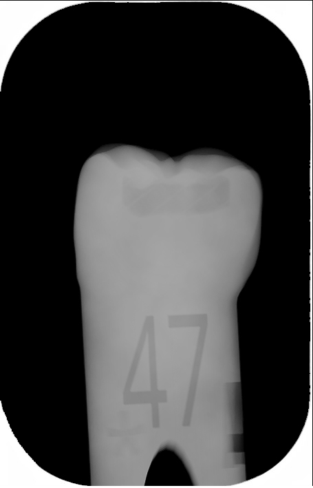 Leeds 3D Printed Model | Leeds Digital Dentistry